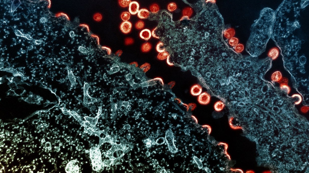 What are the deadliest viruses in history? | Popular Science