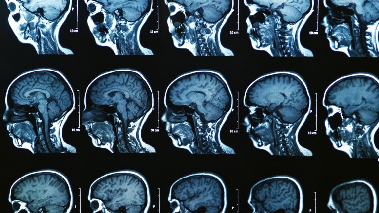 Scientists map the brain on mind-altering drugs | Popular Science