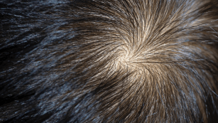 Genes really can influence the shape of our hair patterns | Popular Science