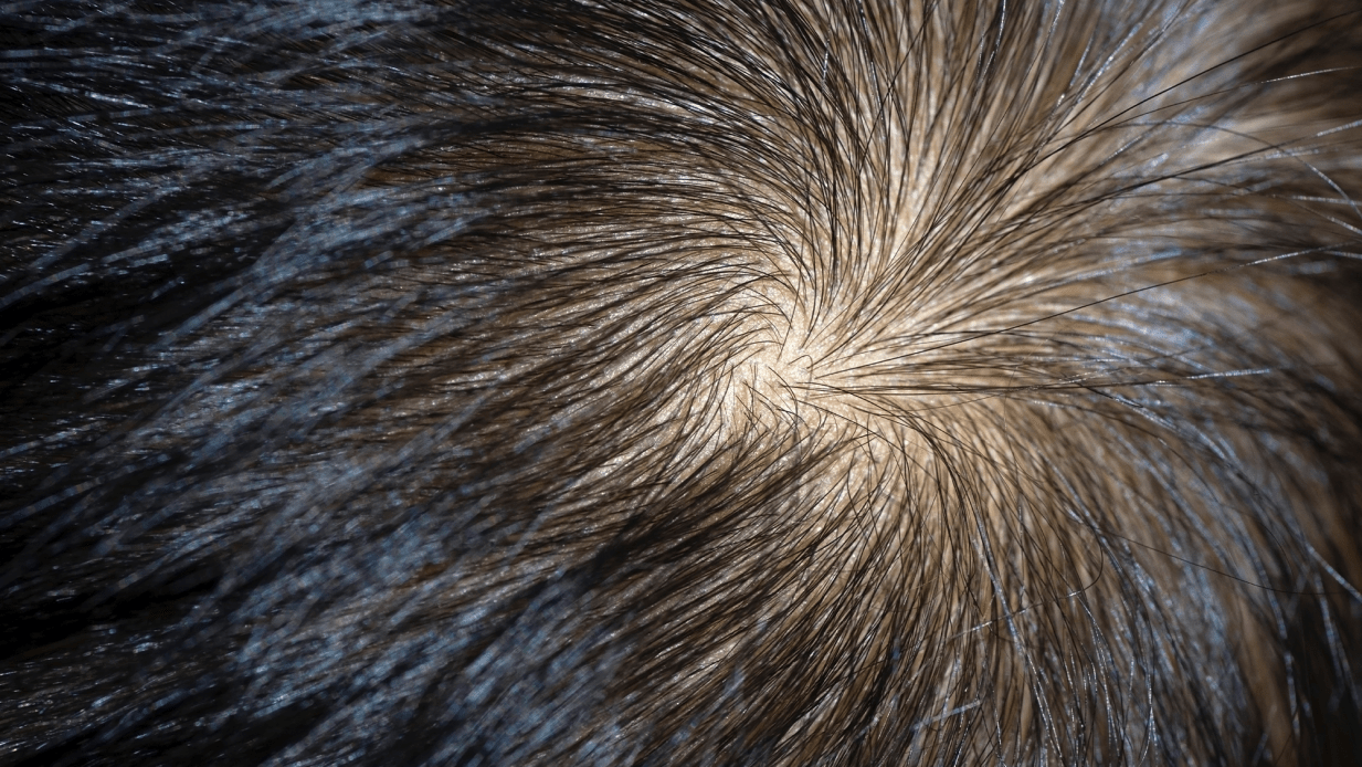 Genes really can influence the shape of our hair patterns | Popular Science