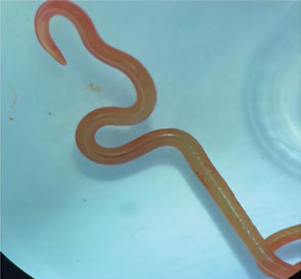 Parasitic worm found ‘alive and wriggling’ in a woman's brain | Popular ...