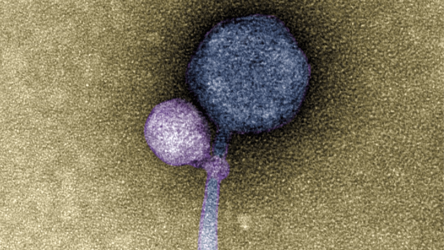Vampire virus attached to another virus observed for the first time ...
