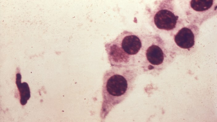 FDA authorizes at-home chlamydia and gonorrhea test for the first time ...