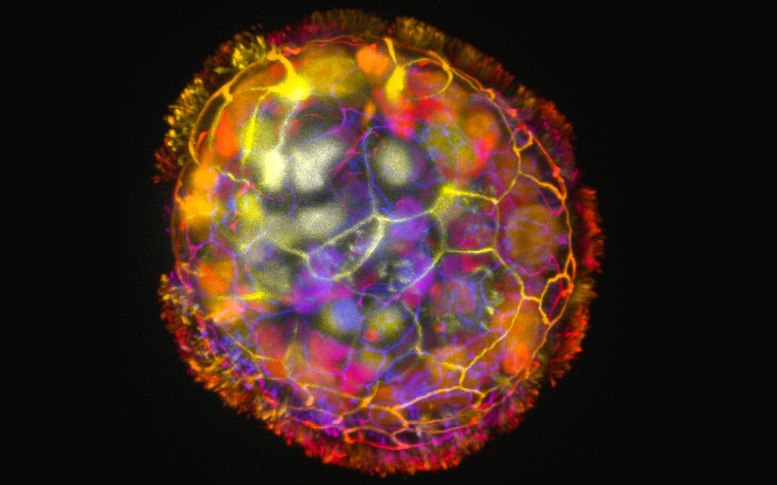 Meet ‘anthrobots,’ tiny bio-machines built from human tracheal cells ...