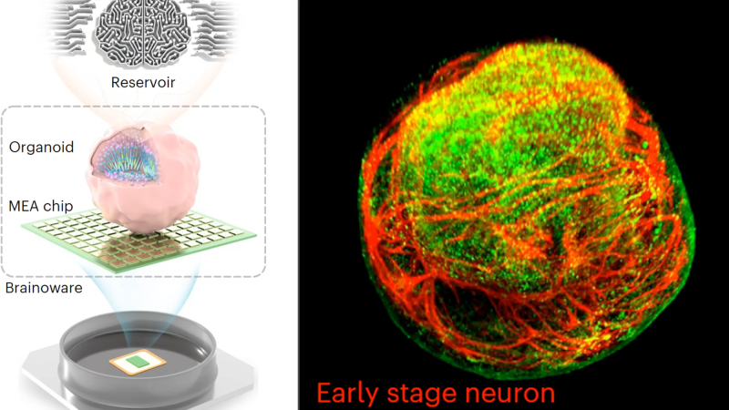Scientists have 3D bioprinted functioning human brain tissue | Popular ...