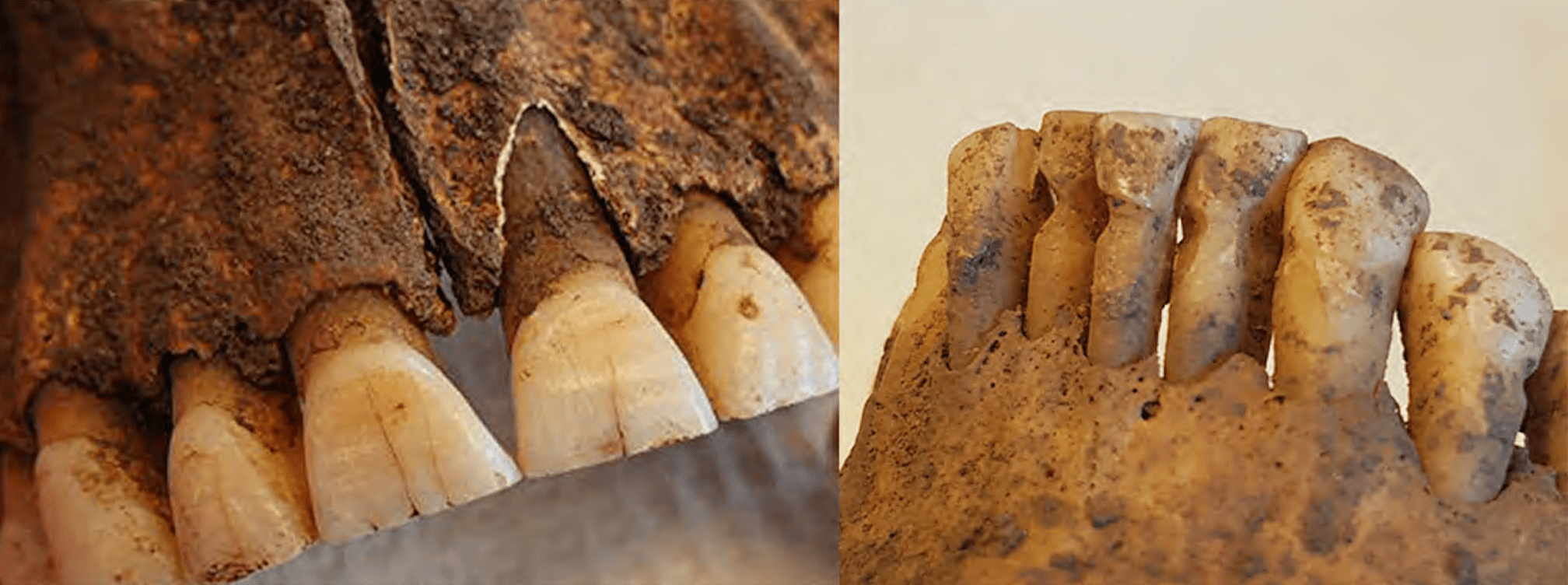 Vikings filed their teeth to cope with pain | Popular Science