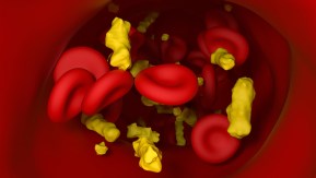 Everything you need to know about cholesterol | Popular Science