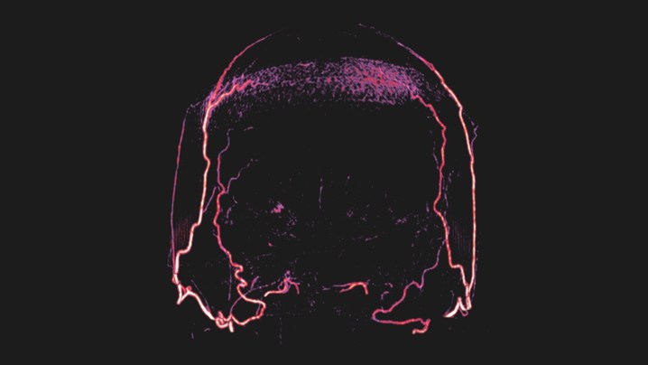 The allure and dangers of experimenting with brain-dead bodies ...