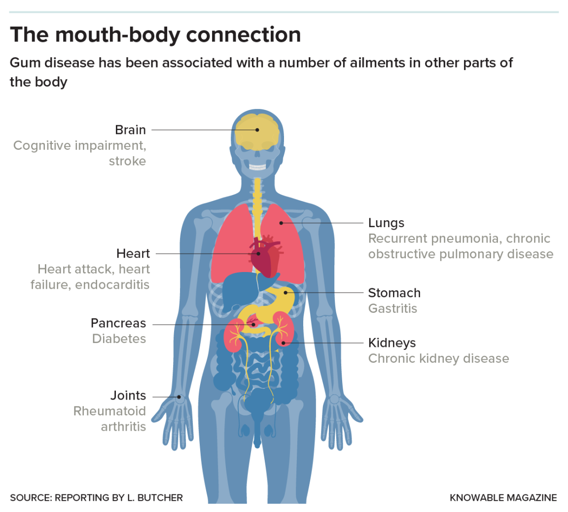 Why isn’t dental health considered primary medical care? | Popular Science
