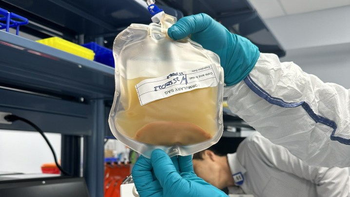 Experimental treatment grows livers from lymph nodes | Popular Science