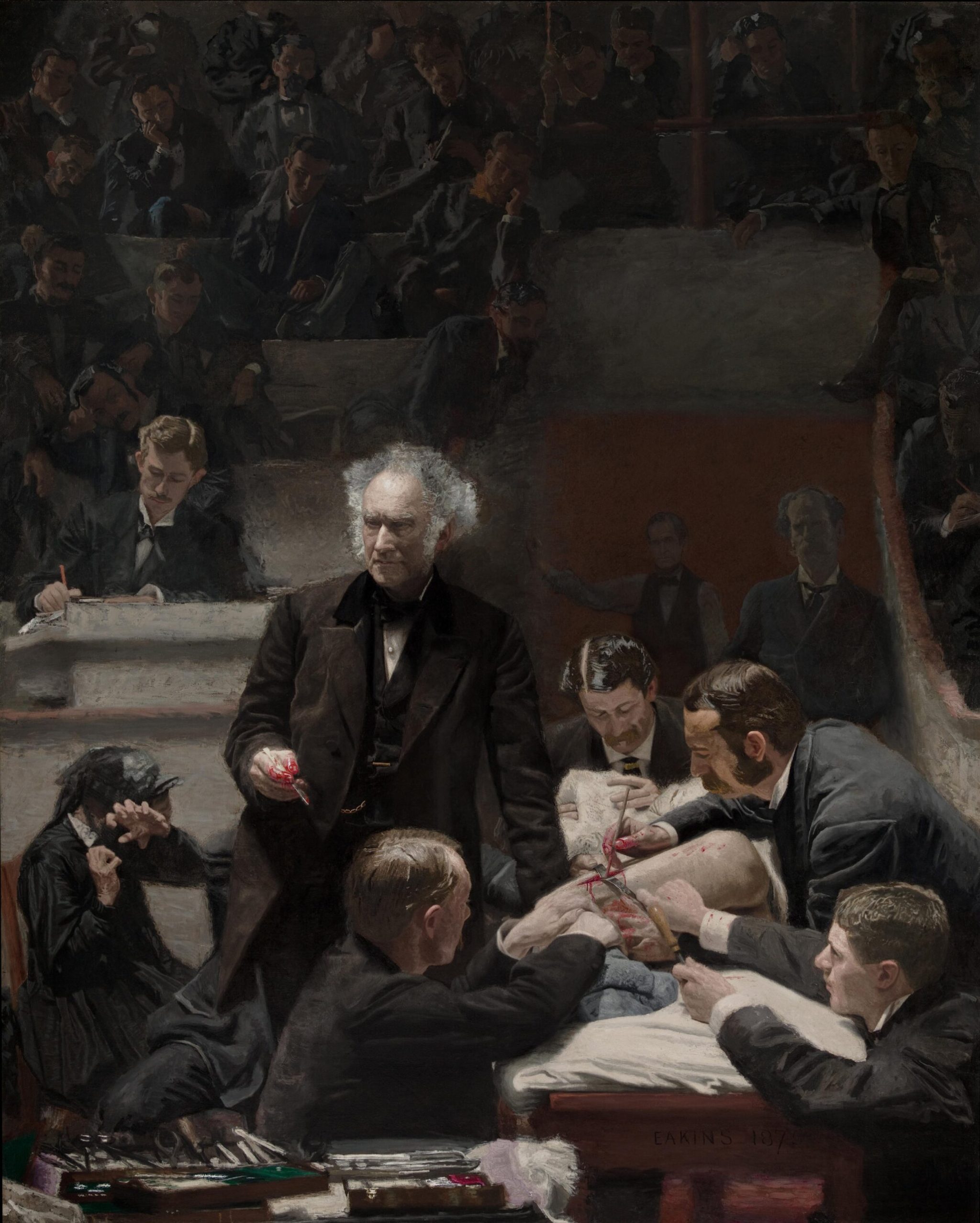 When surgery was a public spectacle | Popular Science