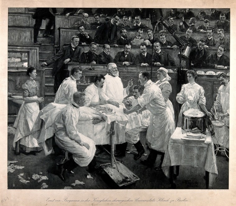 When surgery was a public spectacle | Popular Science