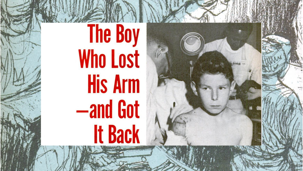 The world's first successful limb re-attachment is a fascinating story ...