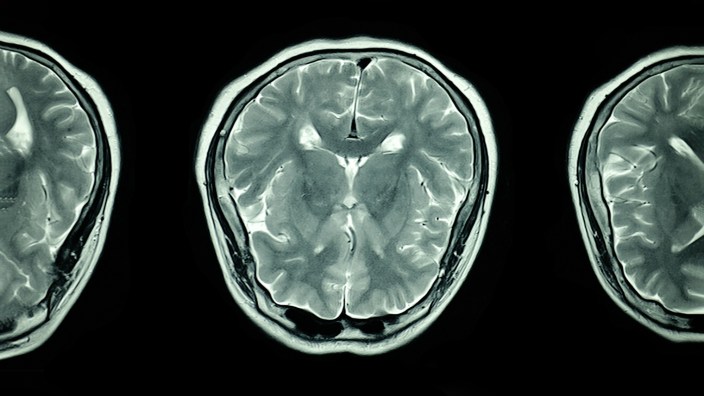 The man who lived with no brain | Popular Science