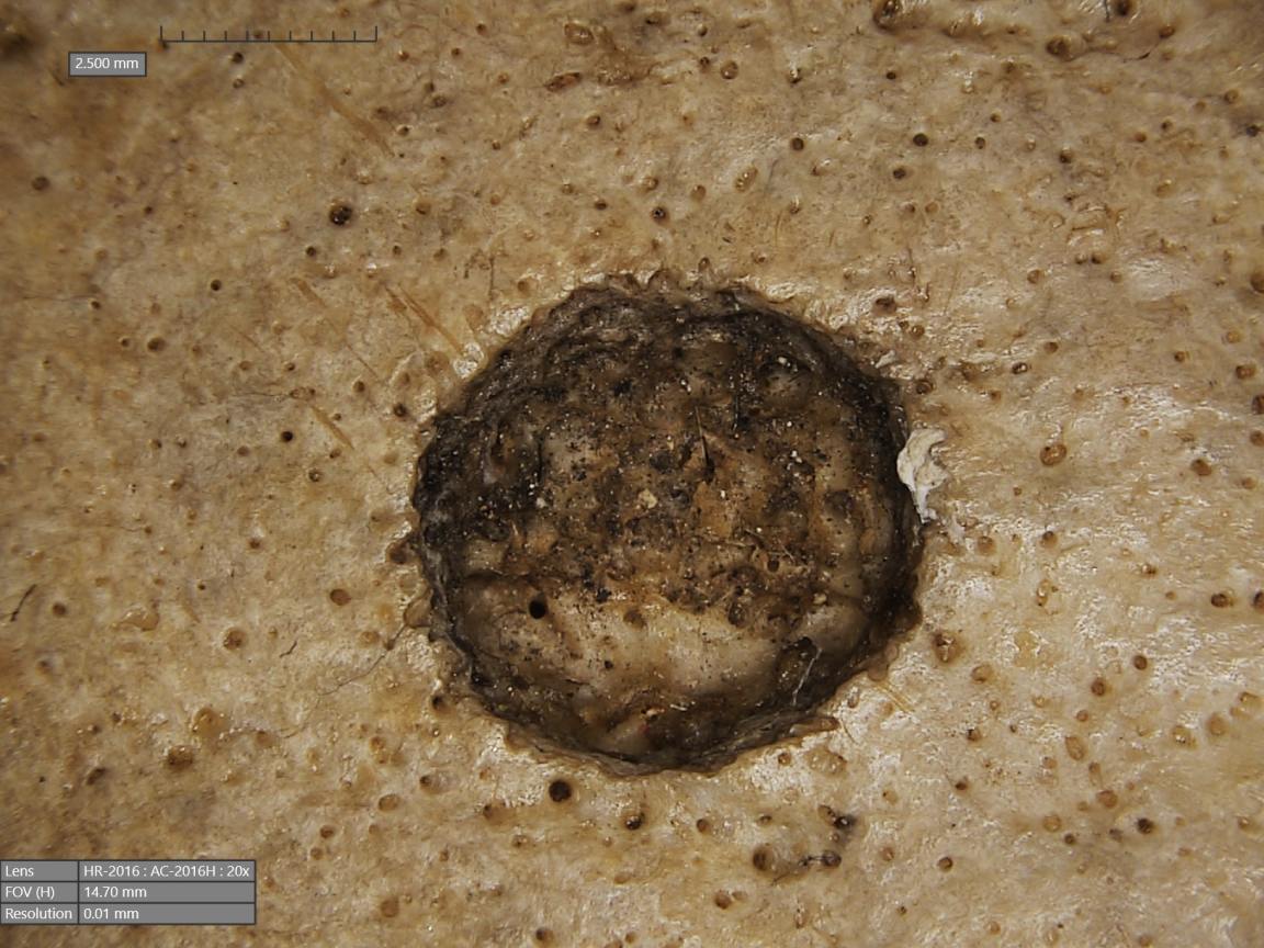 4,000 year-old Egyptian skulls show attempts at brain surgery to treat ...
