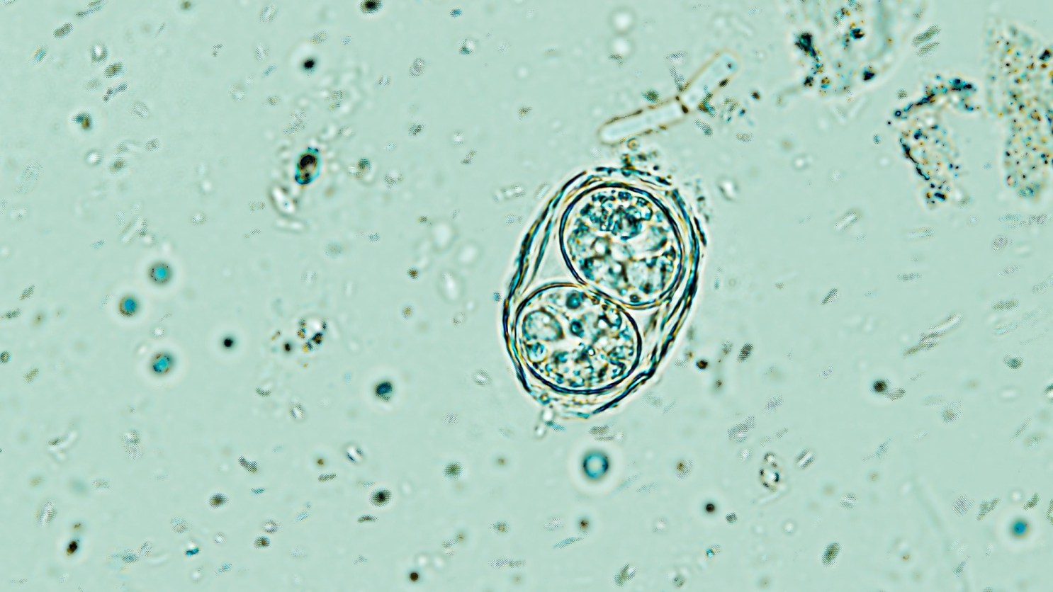 Bioengineered parasites may one day deliver meds into your brain ...