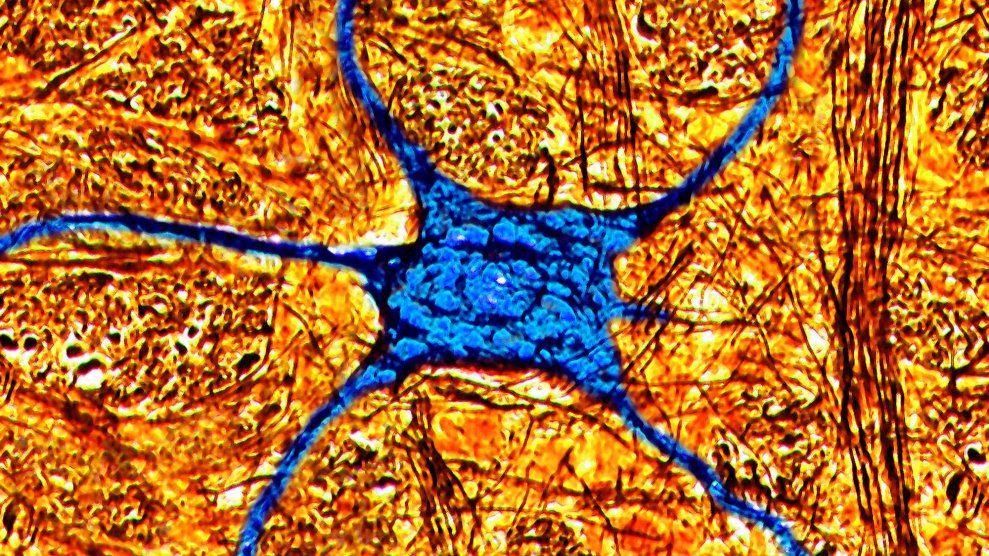 Lab-grown human brain tissue used to control robot | Popular Science