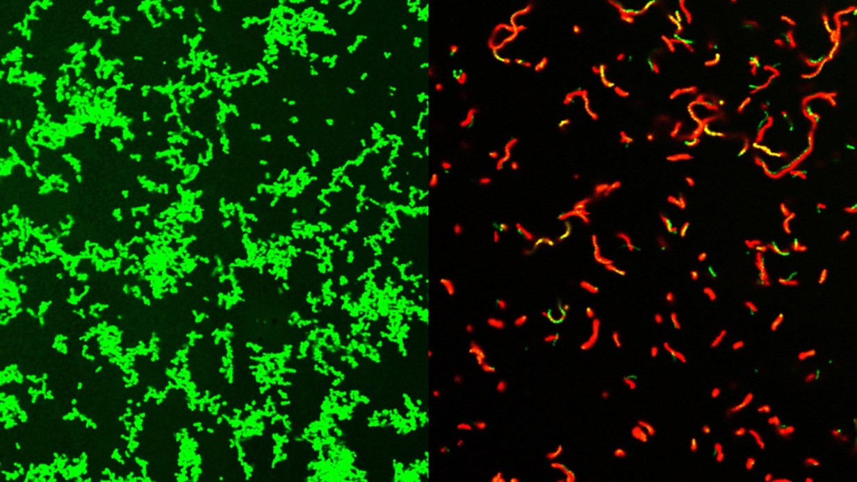 A breakthrough in fighting bacteria that causes 'flesh-eating' illness ...