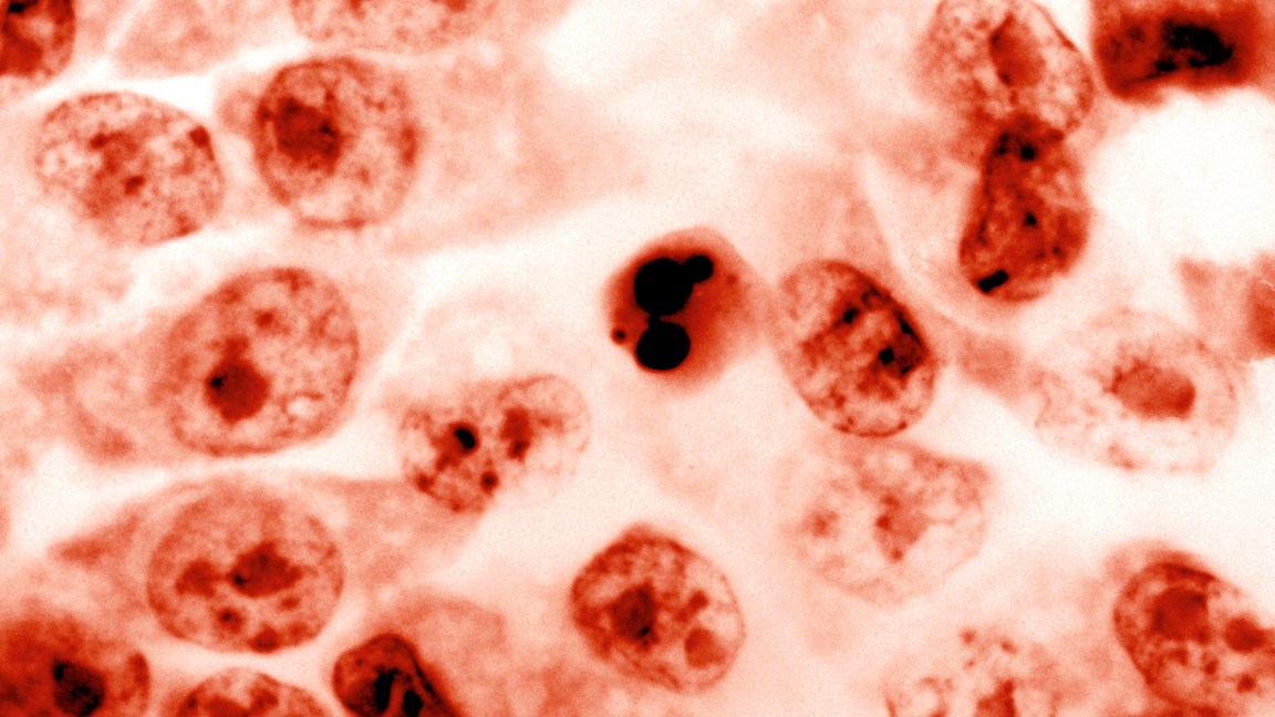 Your cells are dying. All the time. | Popular Science