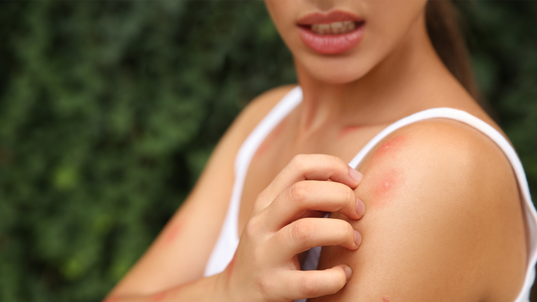 Why scratching a rash really does make it worse | Popular Science