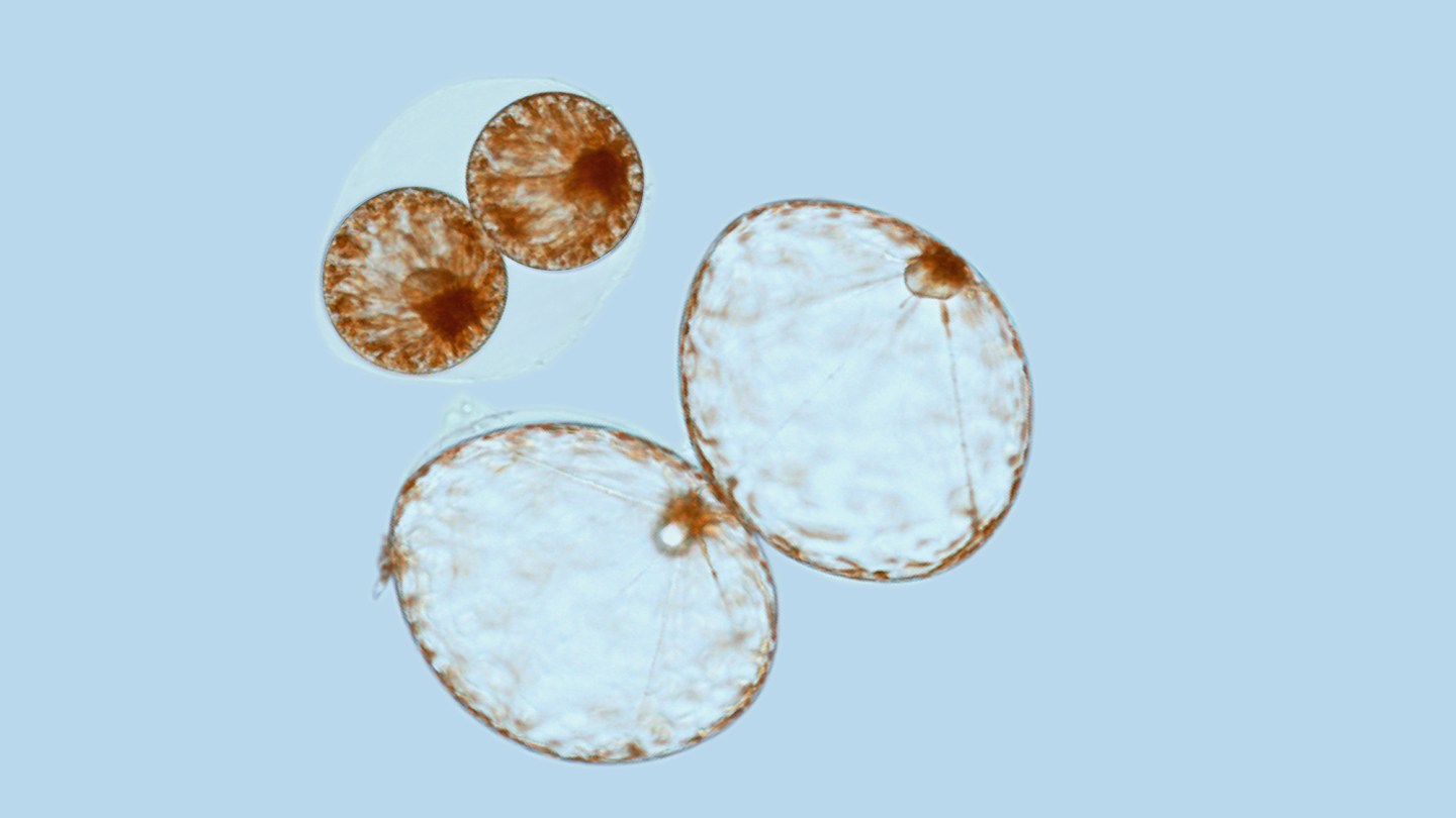 Why these plankton puff up to 6x bigger than normal | Popular Science