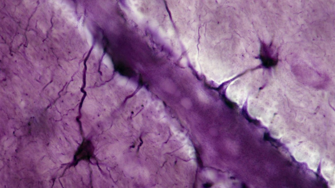 'Swiss army knife' of the brain: How star-shaped cells reshape our ...