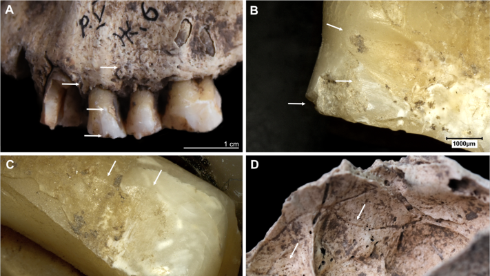 Human-like teeth successfully grown in a pig’s mouth | Popular Science