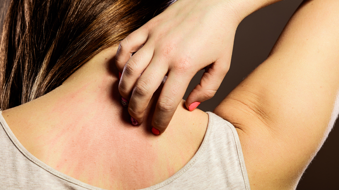 Why scratching a rash really does make it worse | Popular Science