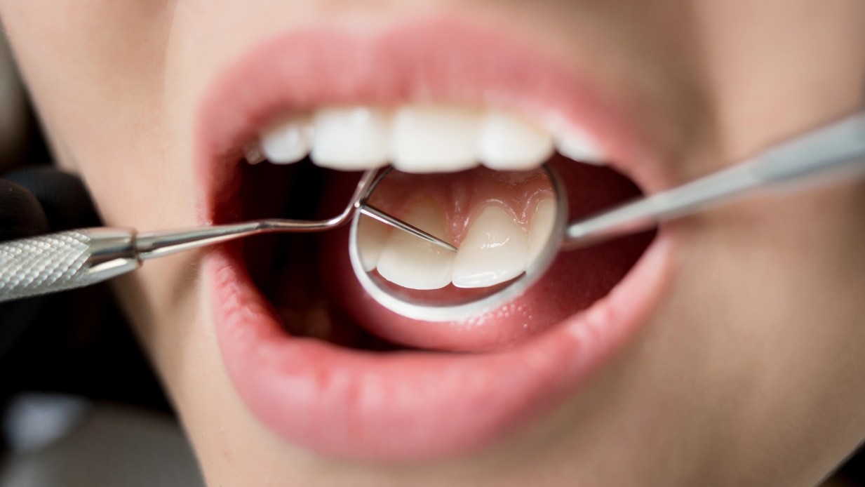 Lab-grown teeth could be the future of dentistry | Popular Science