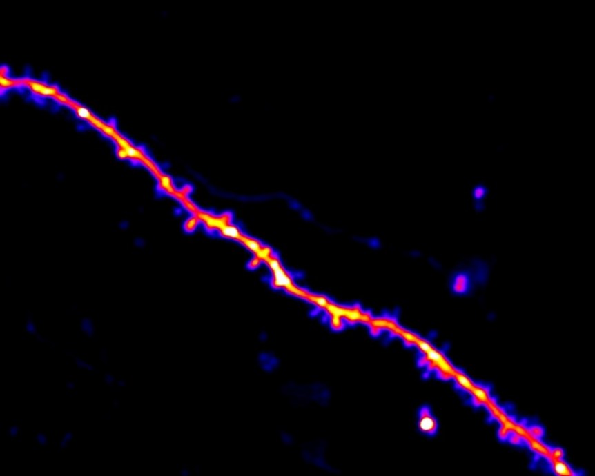 Scientists watch how mice learn, one synapse at a time | Popular Science