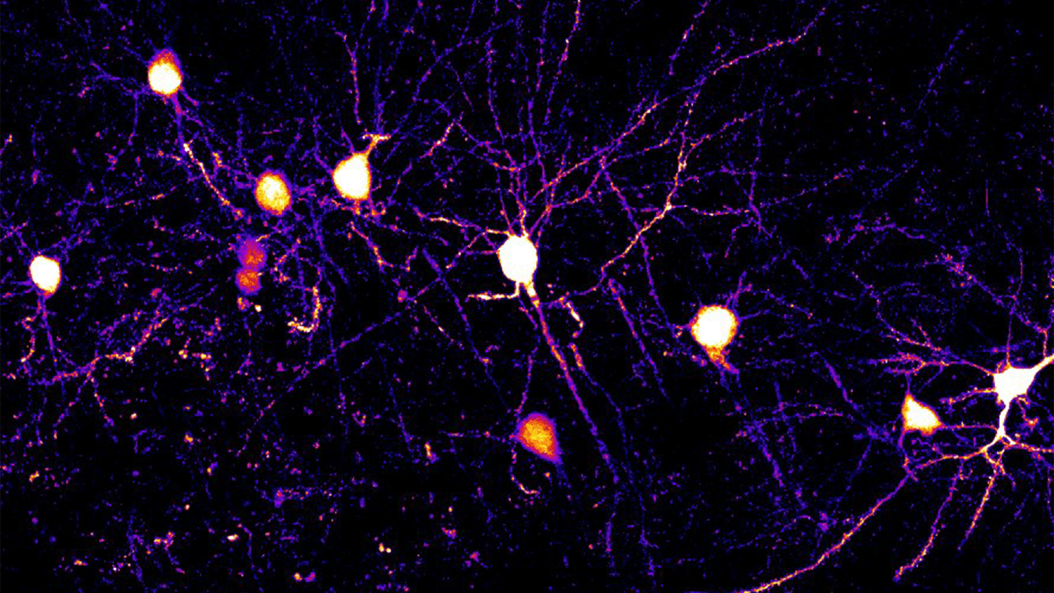 Scientists watch how mice learn, one synapse at a time | Popular Science