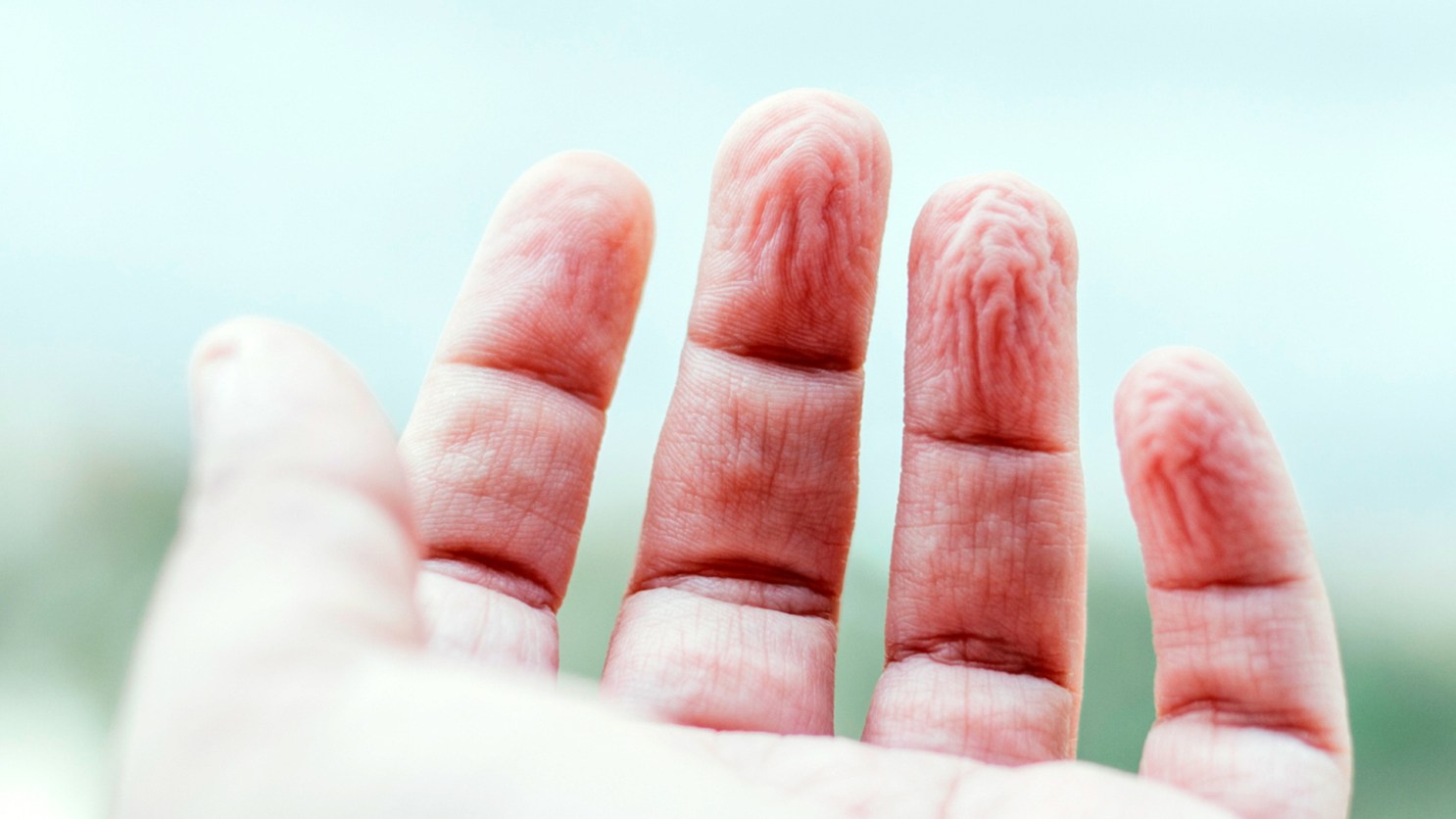 Why do our fingers wrinkle in water? It's much deeper than skin ...