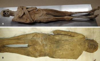 Mummified Austrian priest’s rectum played important role in ...