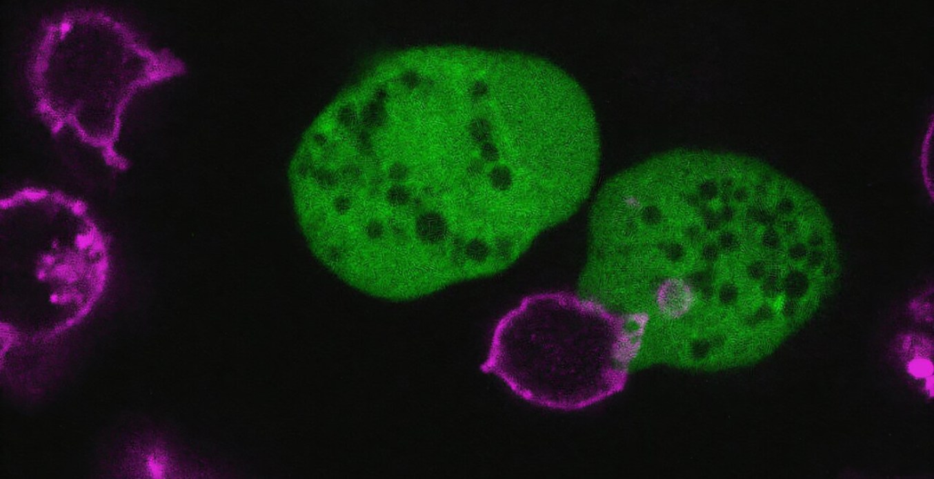 This parasite rips apart human cells and wears them as disguises ...
