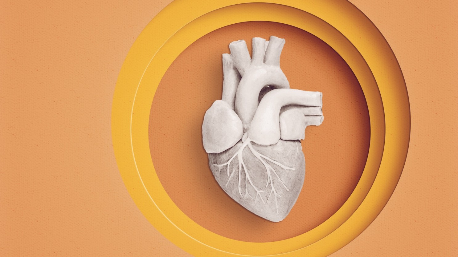 Surgeons develop 2 ways to 'restart' hearts without a donor's body ...