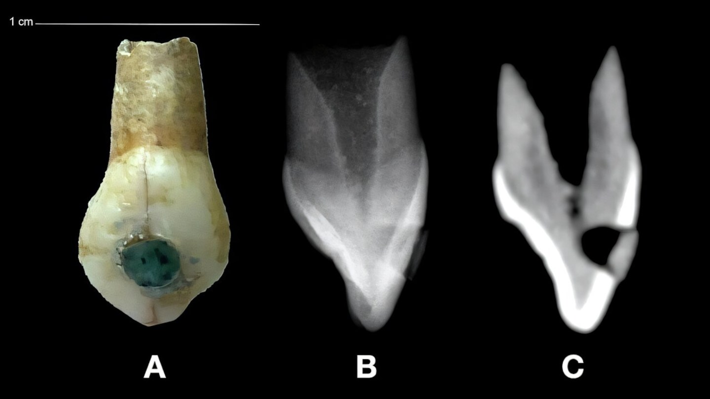 Jade gems decorated these Mayan kids' teeth | Popular Science