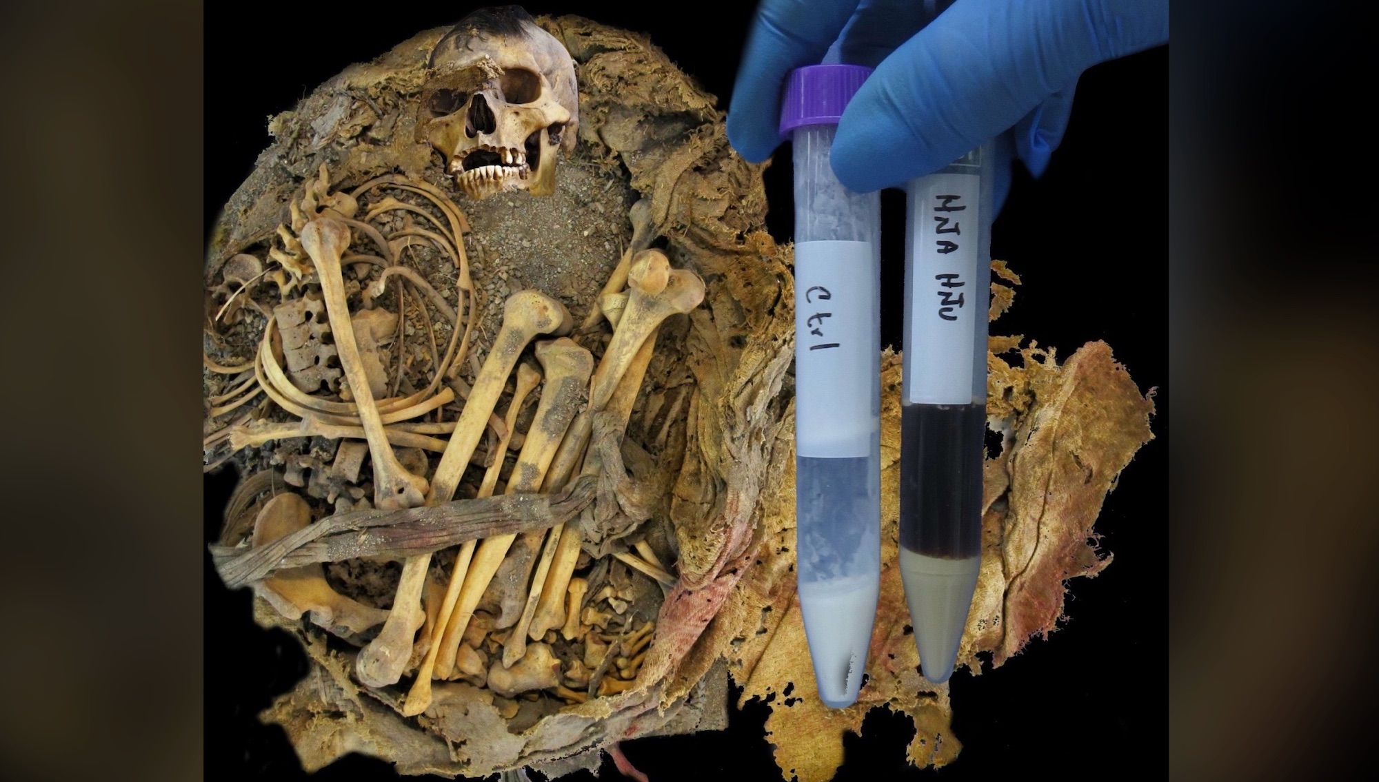 A mummy microbiome hides inside 1,000-year-old poop | Popular Science