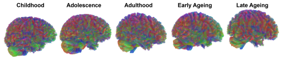 Your brain changes at 9, 32, 66, and 83 | Popular Science