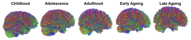 Your brain changes at 9, 32, 66, and 83 | Popular Science