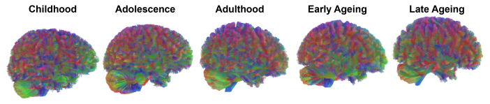 Your brain changes at 9, 32, 66, and 83 | Popular Science