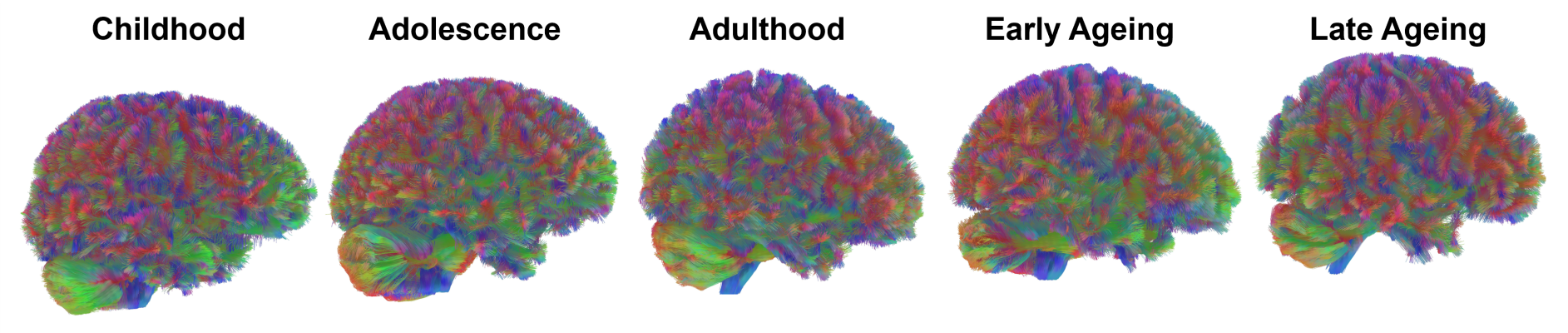 Your brain changes at 9, 32, 66, and 83 | Popular Science