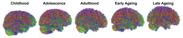 Your brain changes at 9, 32, 66, and 83 | Popular Science