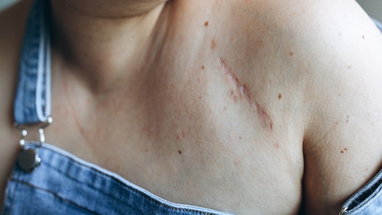 What is shivering? Why our bodies shake when it's cold. | Popular Science
